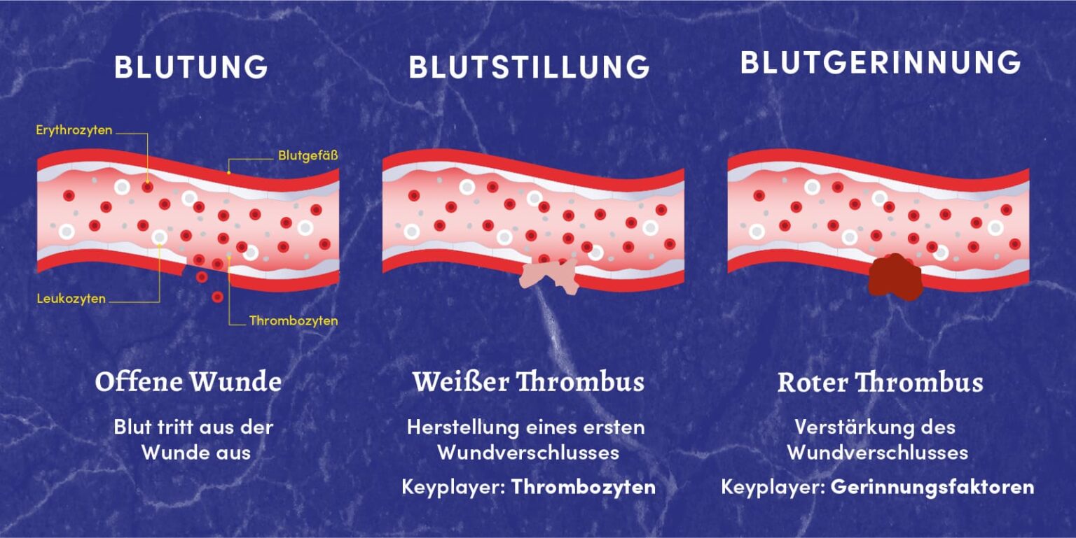 Ablauf der Blutgerinnung