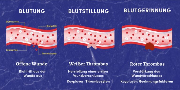 Ablauf der Blutgerinnung